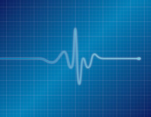 Heartbeat Free Stock Photo - Public Domain Pictures