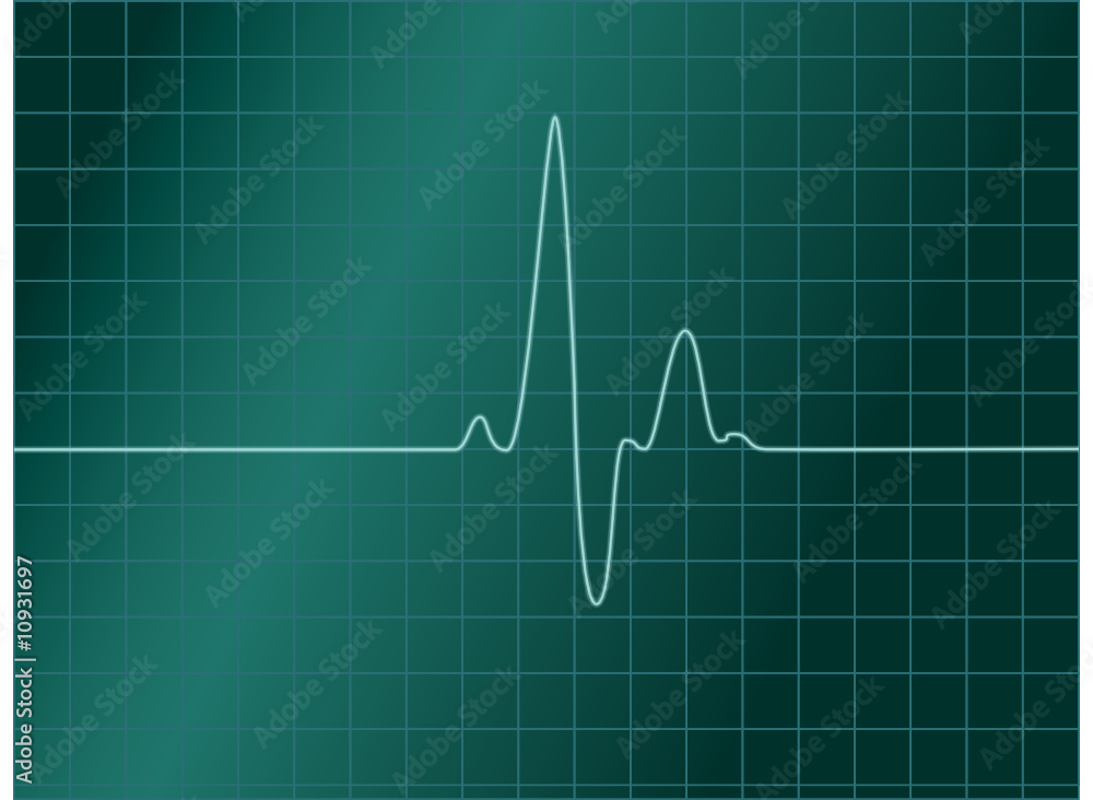 Image vectorielle Stock éléctro-cardiogramme | Adobe Stock