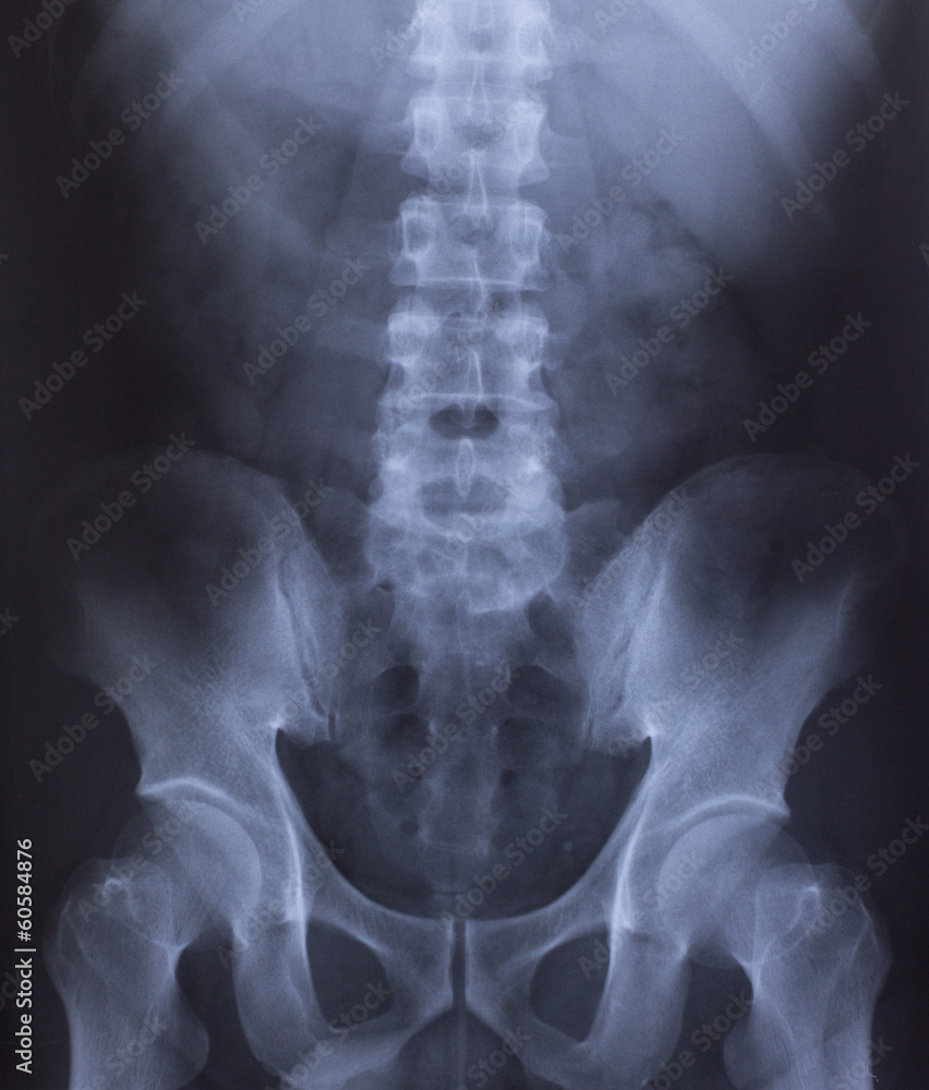 X-ray of the pelvis and spinal column. Stock Photo | Adobe Stock