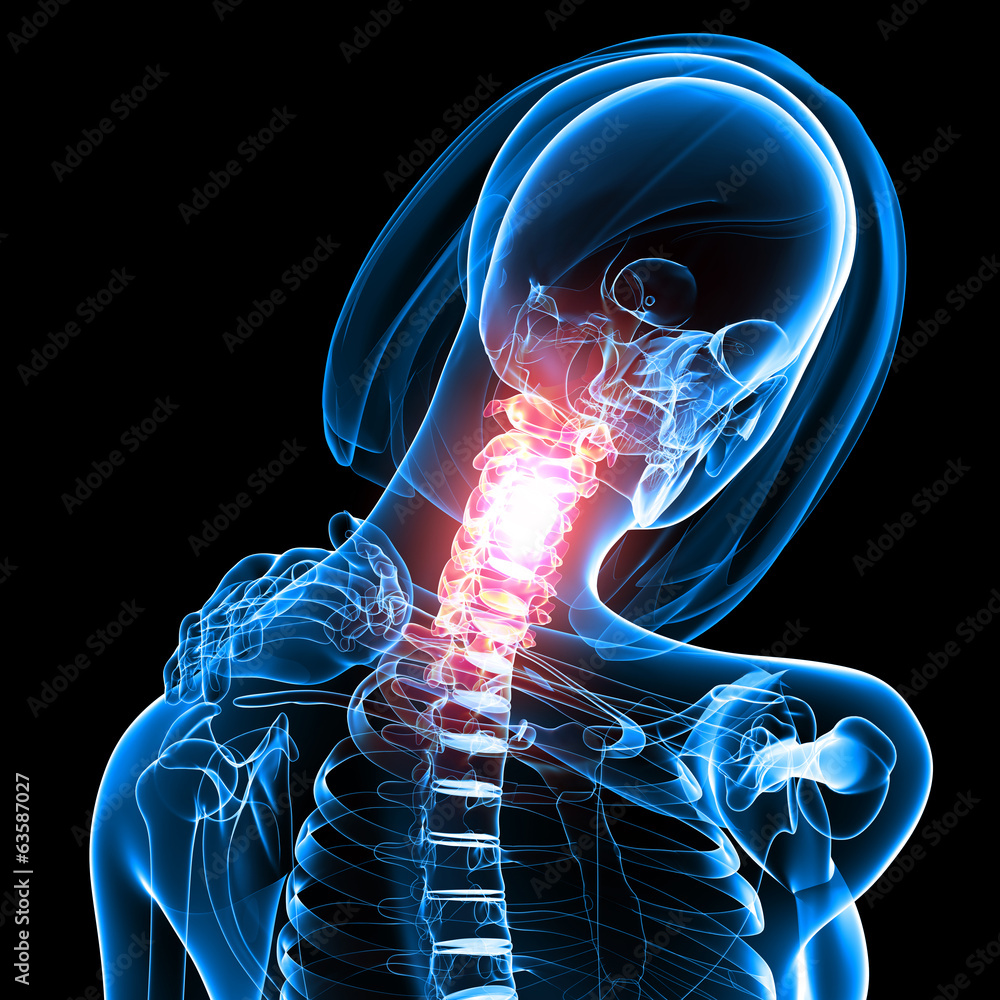 3d Anatomy of female neck pain Stock Illustration | Adobe Stock