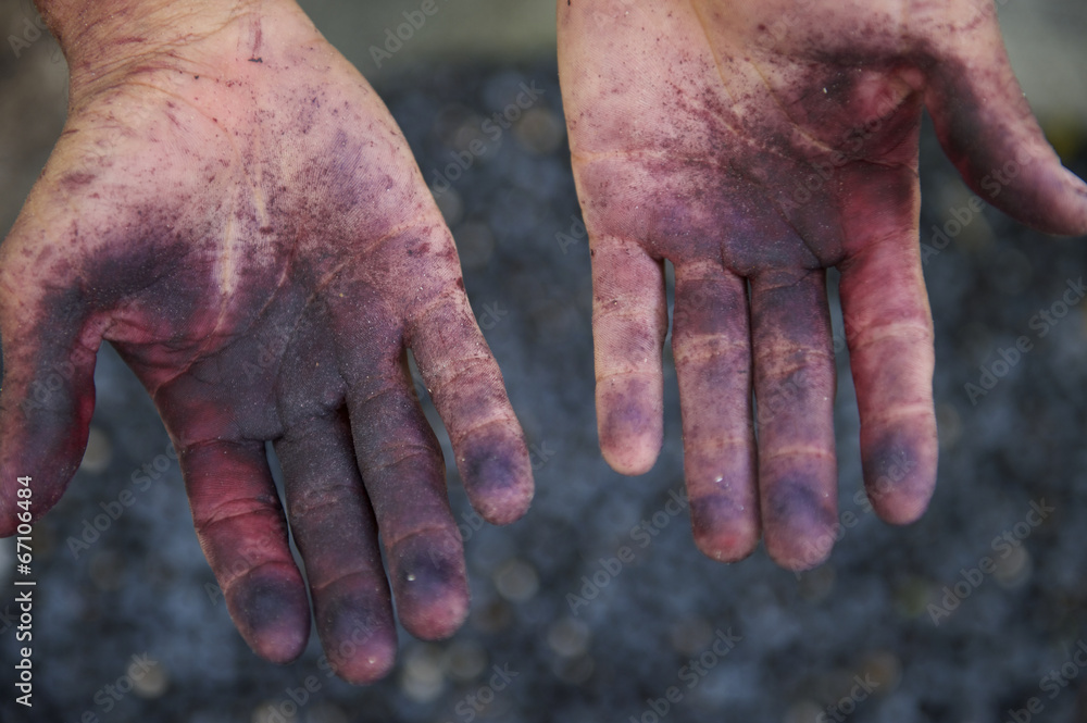 Brazilian Hands Stained from Acai Berries Stock Photo | Adobe Stock