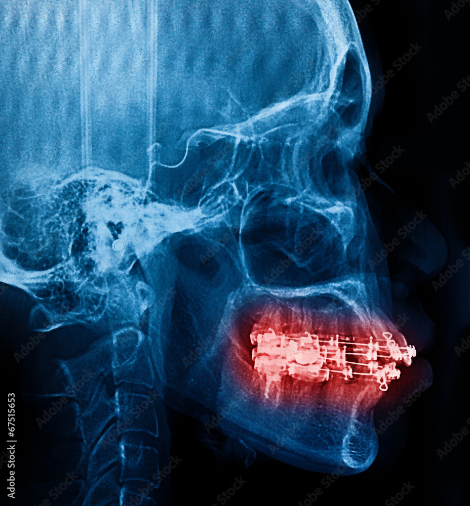 X-Ray scan human for teeth Stock Photo | Adobe Stock