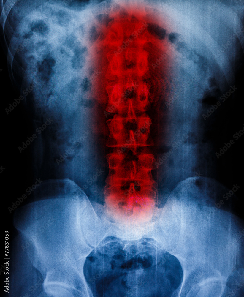 X-Ray scan human Stock Photo | Adobe Stock