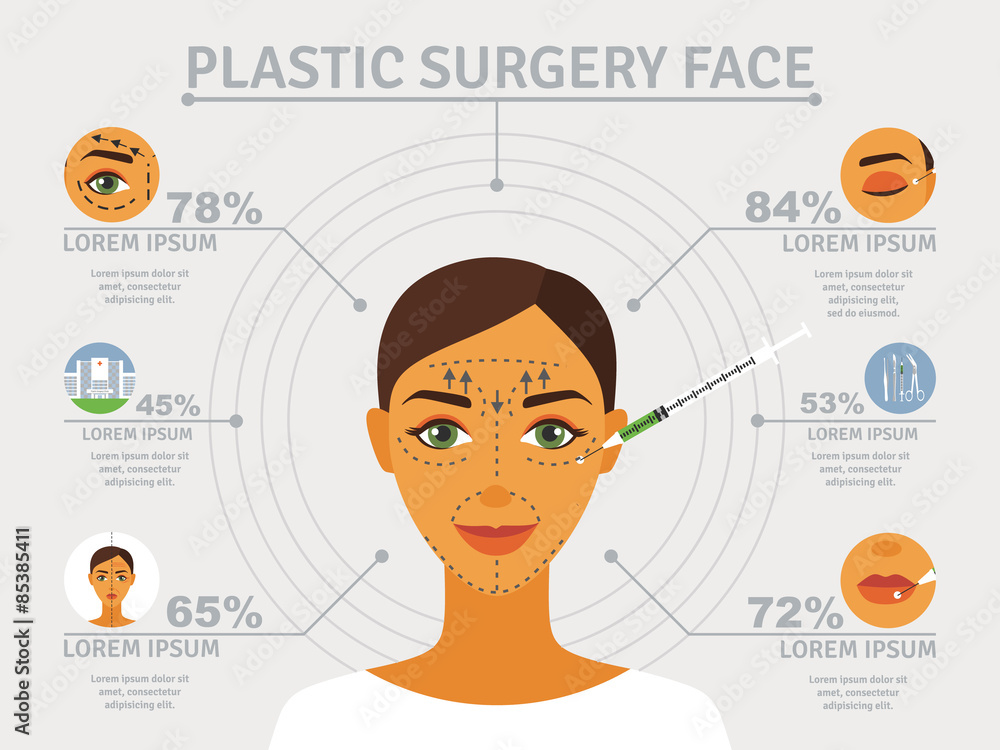 Plastic surgery face infographic poster Stock Vector | Adobe Stock
