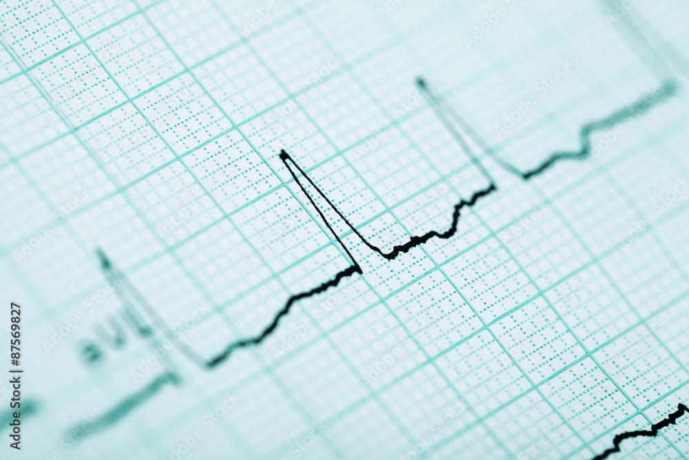 ECG background Stock Photo | Adobe Stock