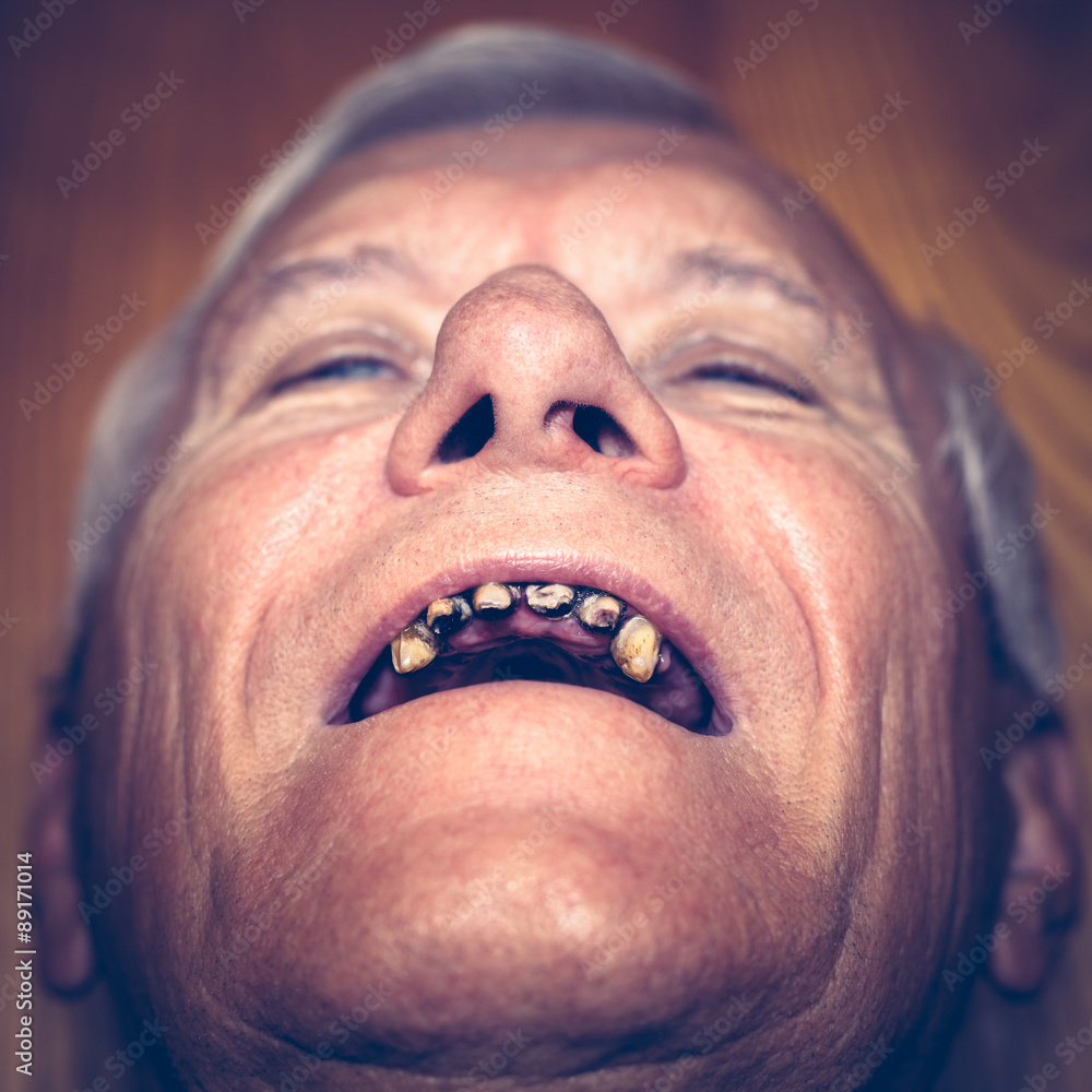 Old man with ugly teeth Stock Photo | Adobe Stock