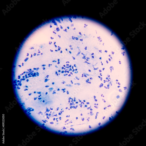 Slide sputum AFB.Negative find with microscope Stock Photo | Adobe Stock
