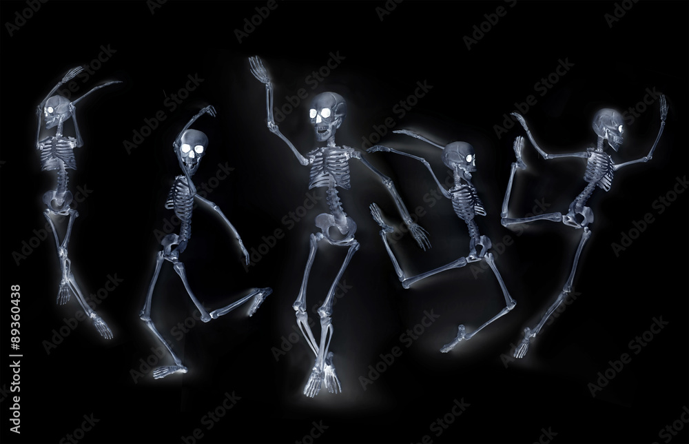 Dancing Skeletons X ray Stock Illustration | Adobe Stock