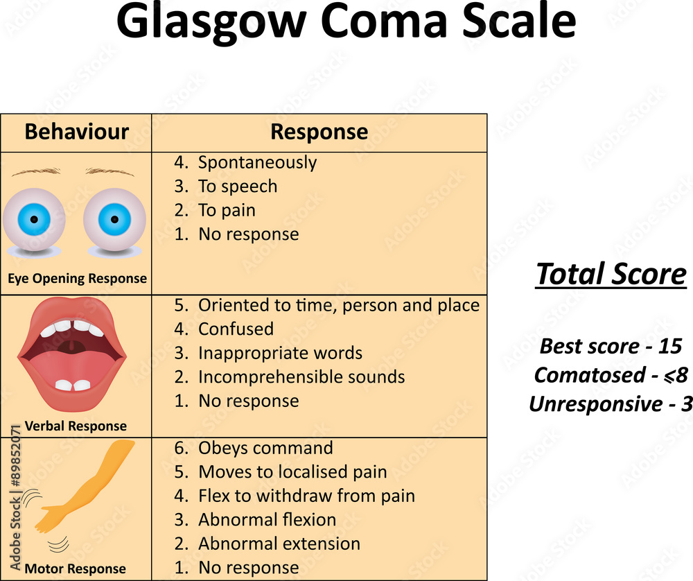 Glasgow Coma Scale Illustration Stock Illustration | Adobe Stock