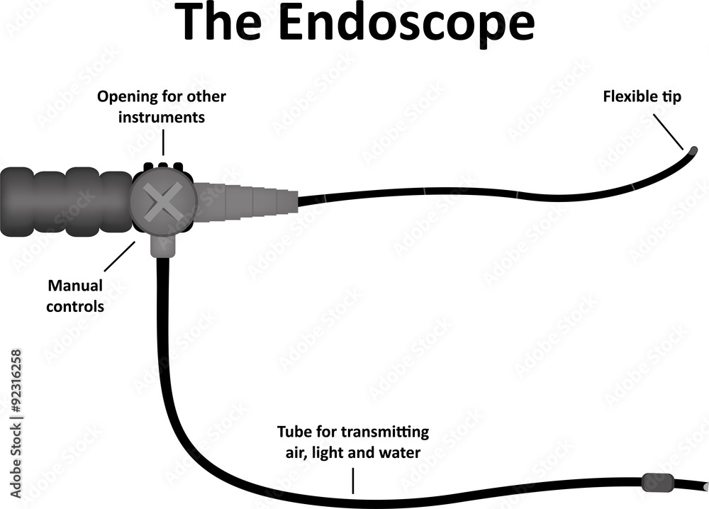 The Endoscope Labelled Diagram Stock Illustration | Adobe Stock