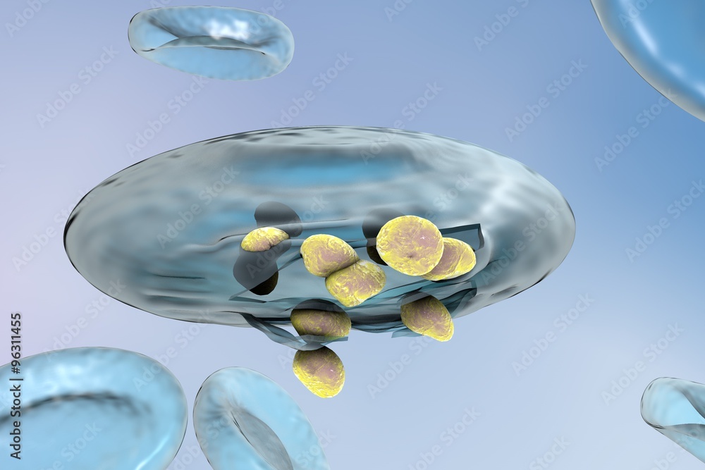 Malaria. Release of malaria parasites from red blood cell. Merozoites ...