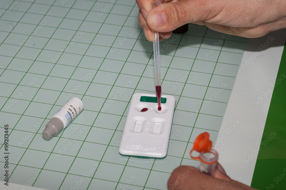 Stock-Foto „La prise de sang et l’analyse sanguine permettent d’étudier ...