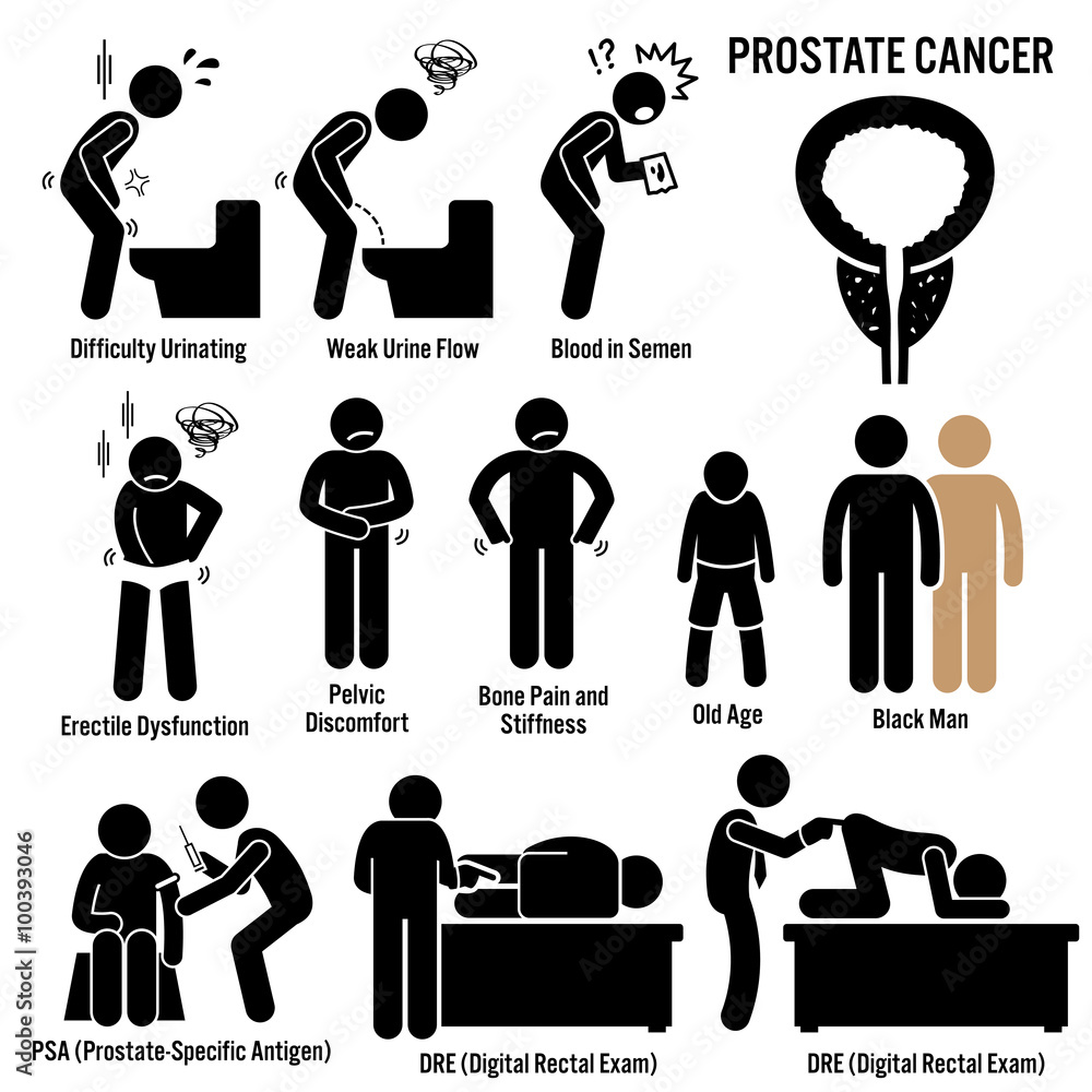 Prostate Cancer Symptoms Causes Risk Factors Diagnosis Stick Figure ...