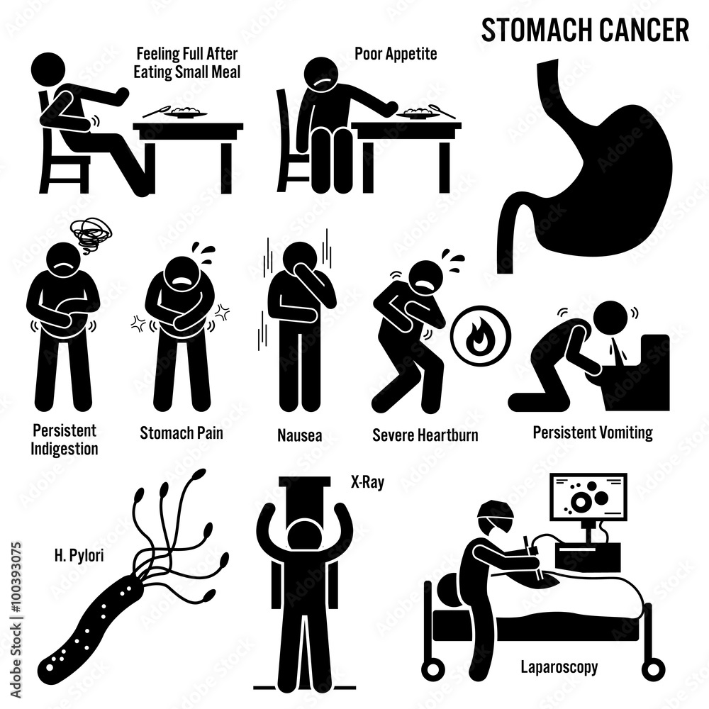 Stomach Cancer Symptoms Causes Risk Factors Diagnosis Stick Figure ...