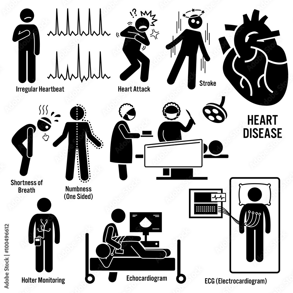 Cardiovascular Disease Heart Attack Coronary Artery Illness Symptoms ...