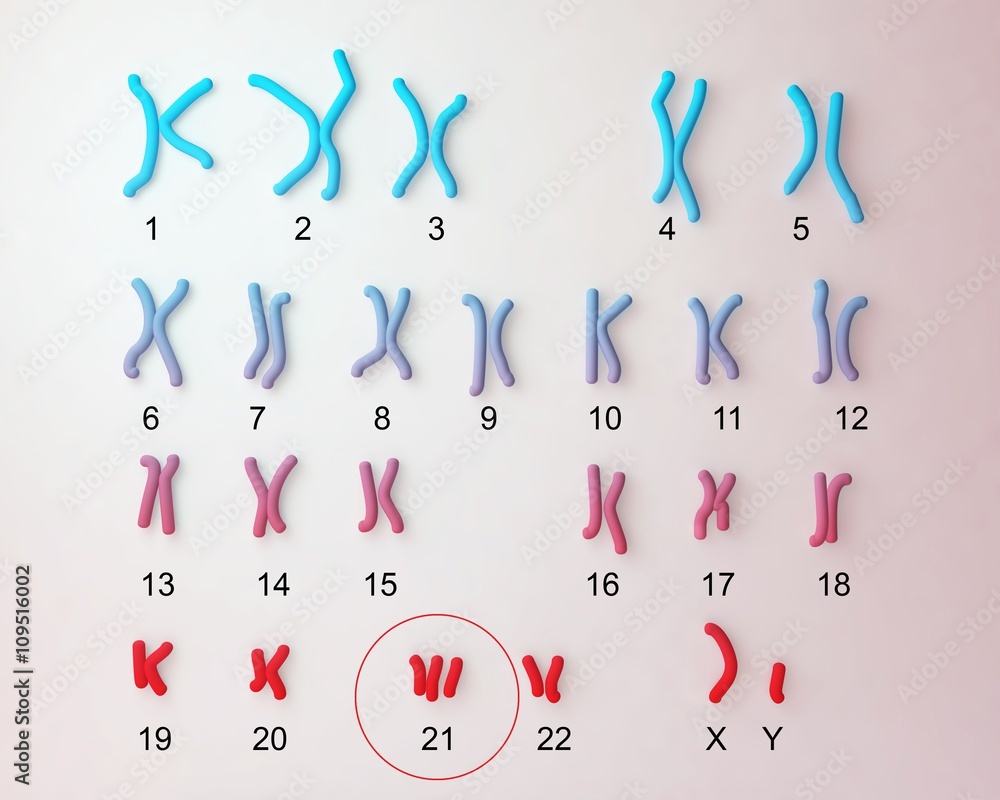 Down-syndrome karyotype, male, labeled. Trisomy 21. 3D illustration ...
