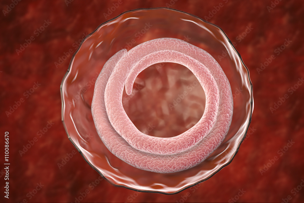 Ilustrace Cyst containing roundworm Trichina spiralis (formely called ...