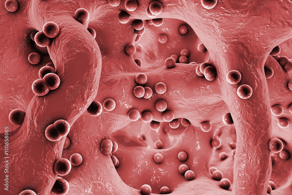 Spherical bacteria inside bone tissue, model of staphylococcus and ...