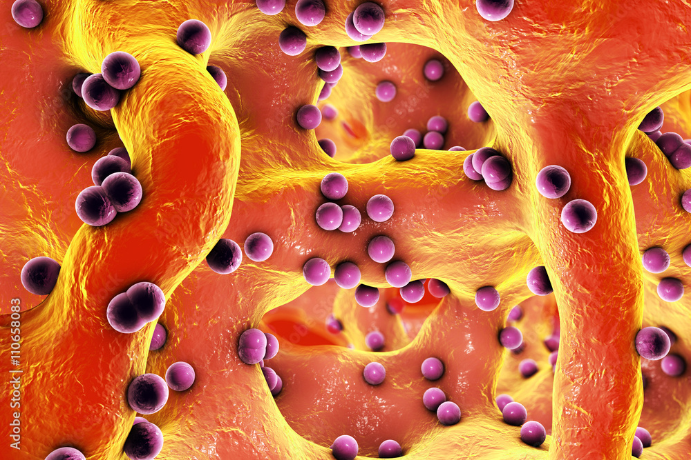 Spherical bacteria inside bone tissue, model of staphylococcus and ...