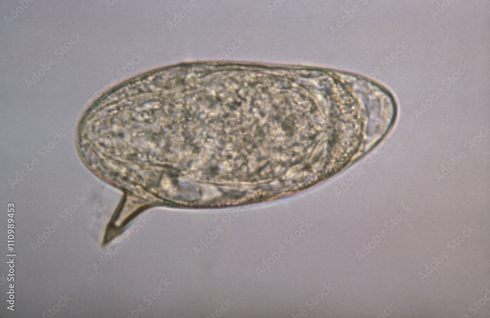 Foto de Stock Schistosoma mansoni egg showing lateral spine ...