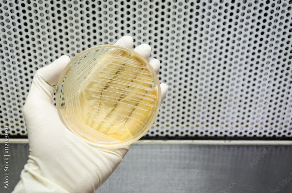 Hand in glove is holding a petri dish of cross streak of Saccharomyces ...