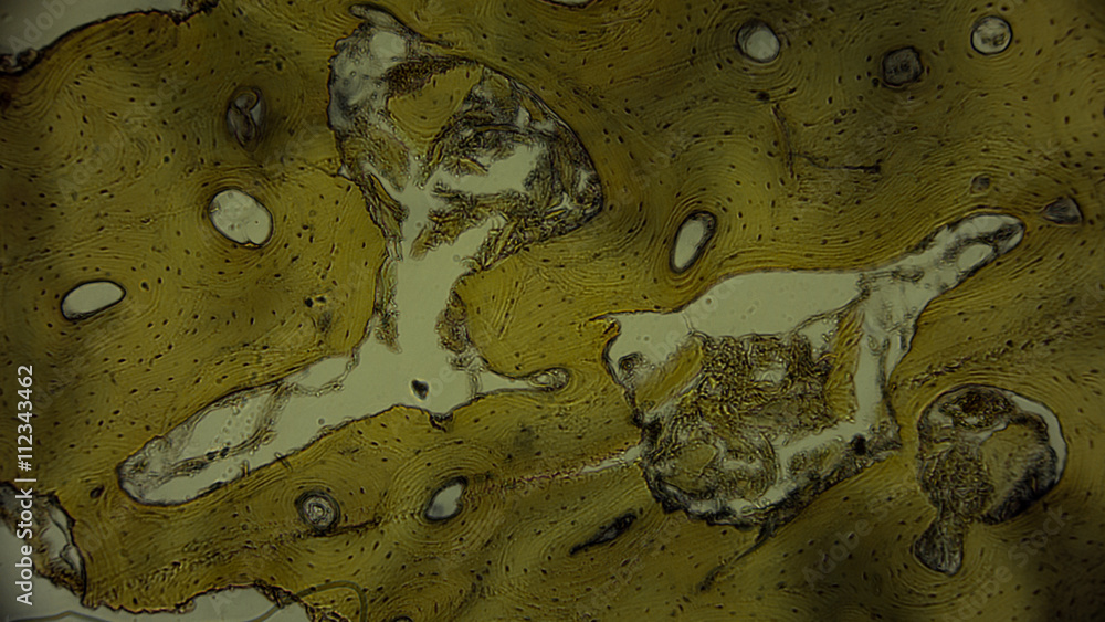 menschliche Zellen unter dem Mikroskop - Anatomie / Histologie ...
