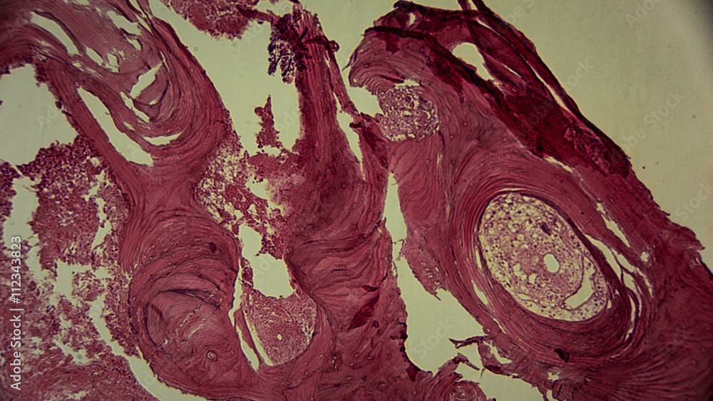 menschliche Zellen unter dem Mikroskop - Anatomie / Histologie ...