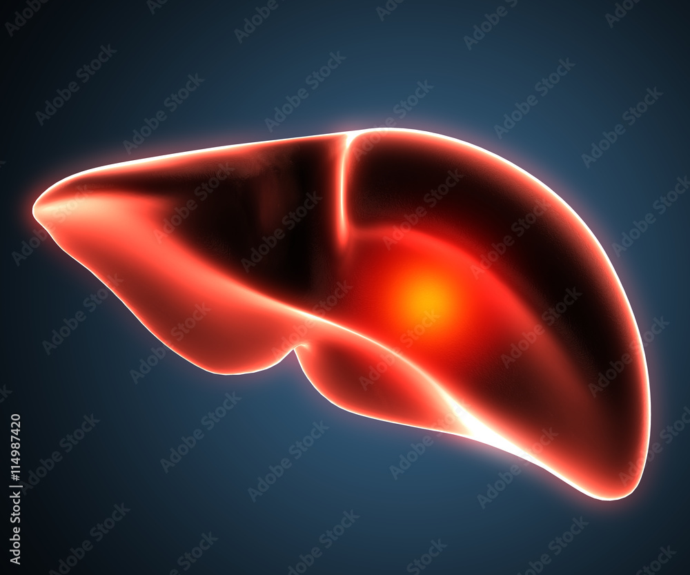 liver disease human anatomy Stock Illustration | Adobe Stock