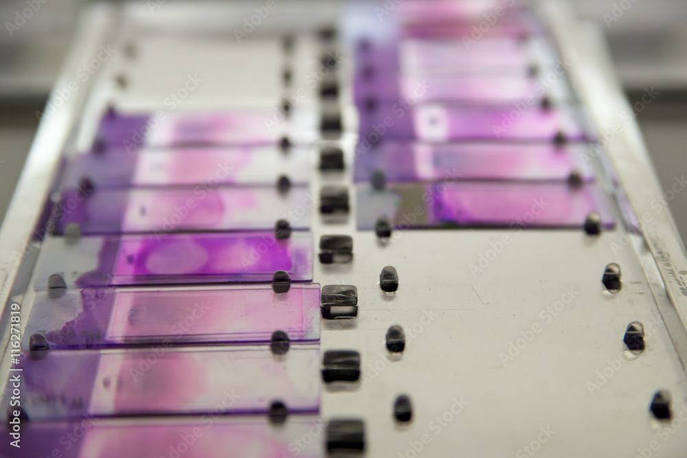 Microscopic slides with blood samples Stock Photo | Adobe Stock