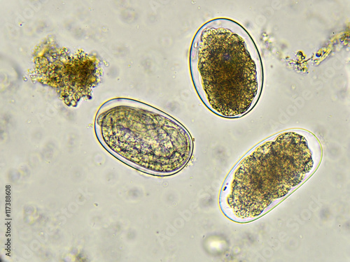Eggs of Hookworm in stool, analyze by microscope Stock Photo | Adobe Stock