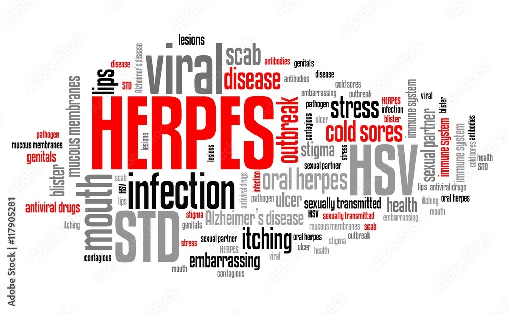 Herpes STD Stock Illustration | Adobe Stock