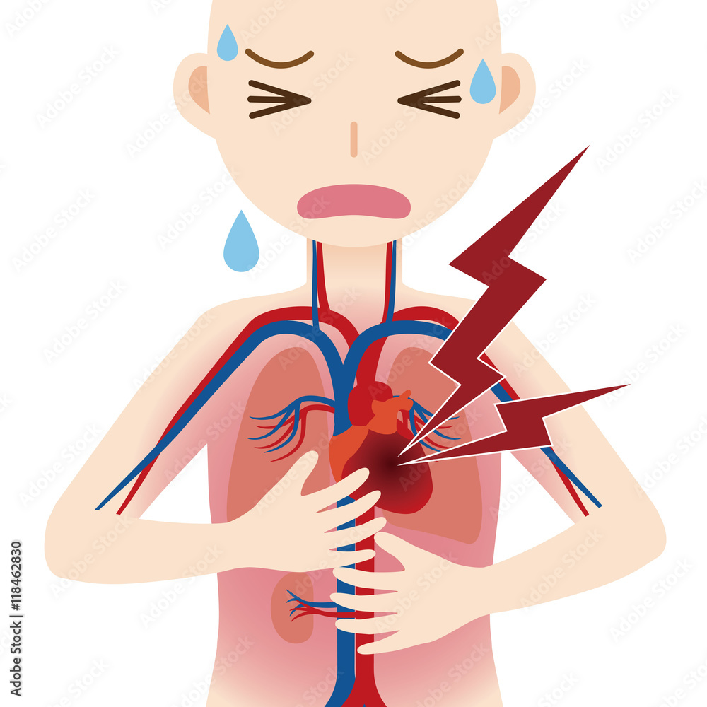 human circulatory system and heart infarction, cardiac infarction ...