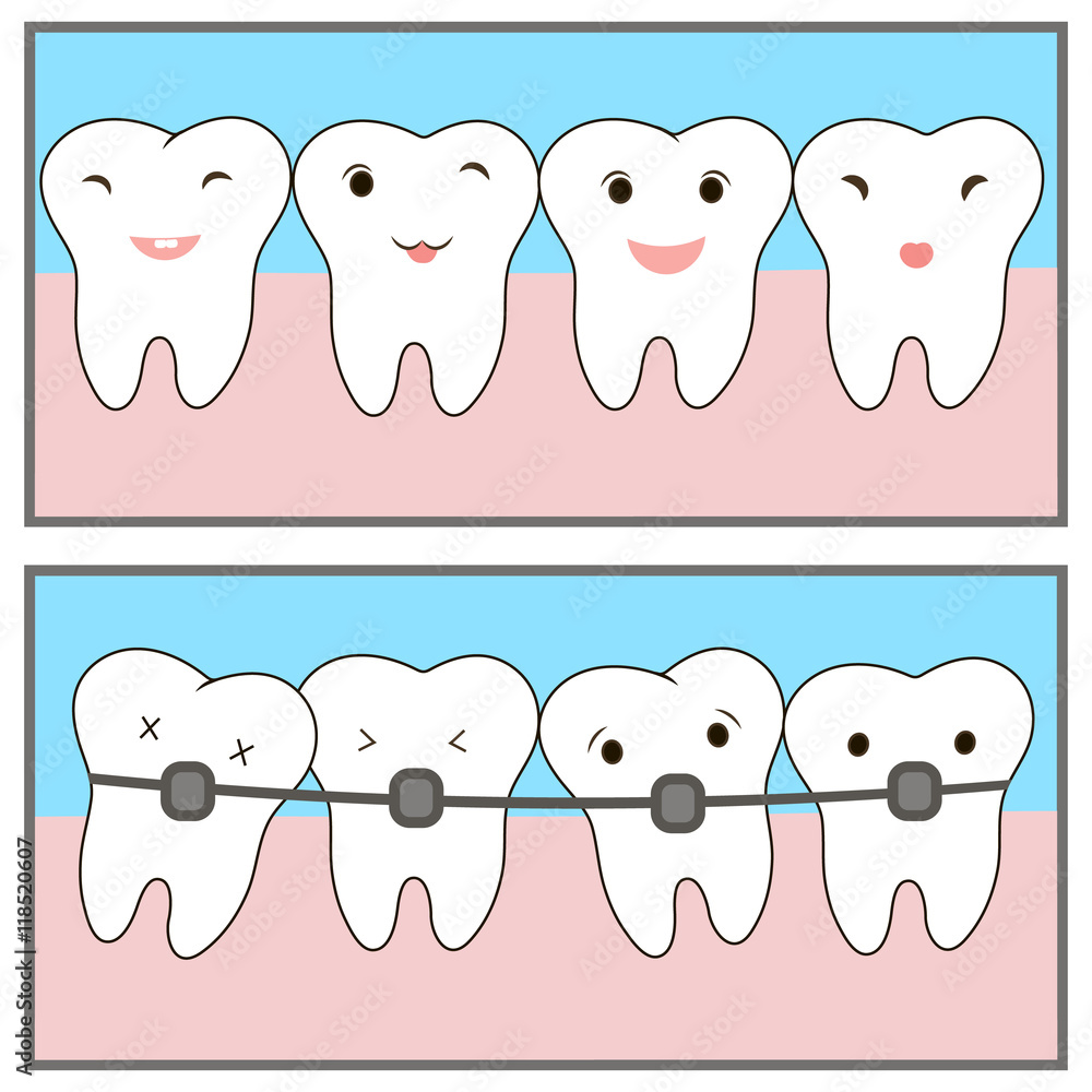 Braces teeth of icon painting line applications websites. Crowding ...