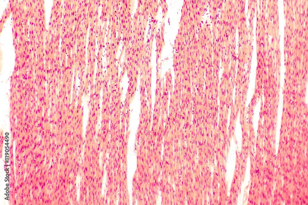 Heart muscle, light micrograph. Striated cardiac muscle cells (myocytes ...