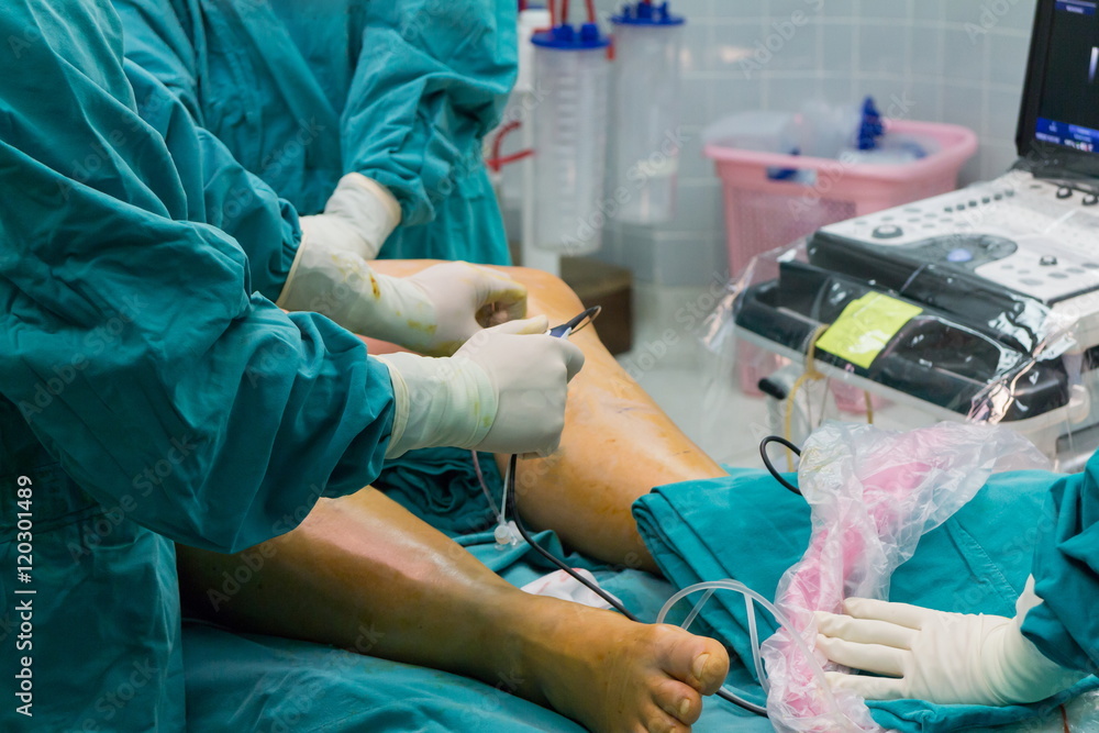 Stock-Foto „Percutaneous transluminal angioplasty ,Vascular bypass ...