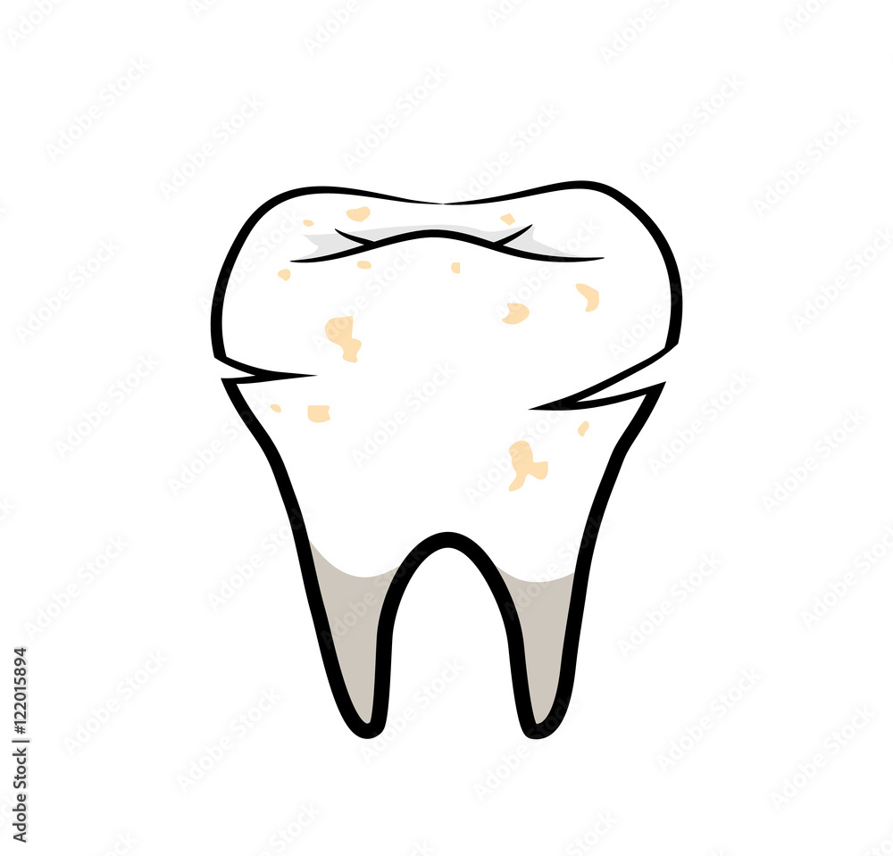 Decaying Tooth Cavity. A hand drawn vector illustration of a decaying ...