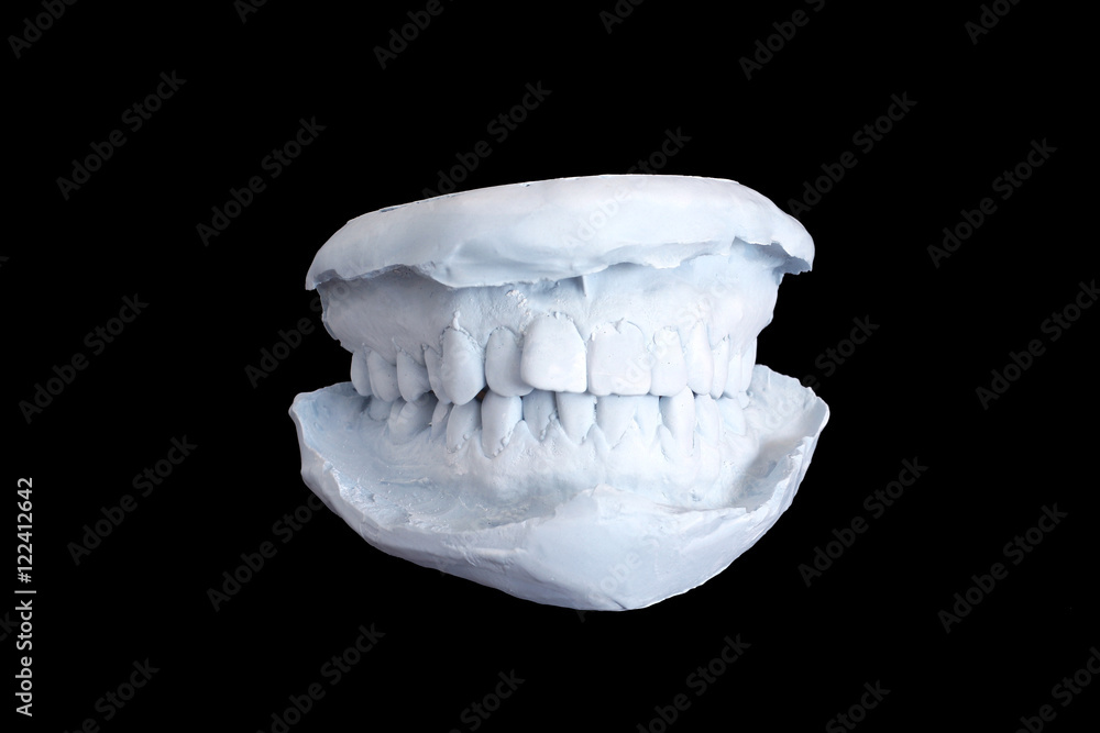 Dental examining, plaster dents model isolated on black background with ...
