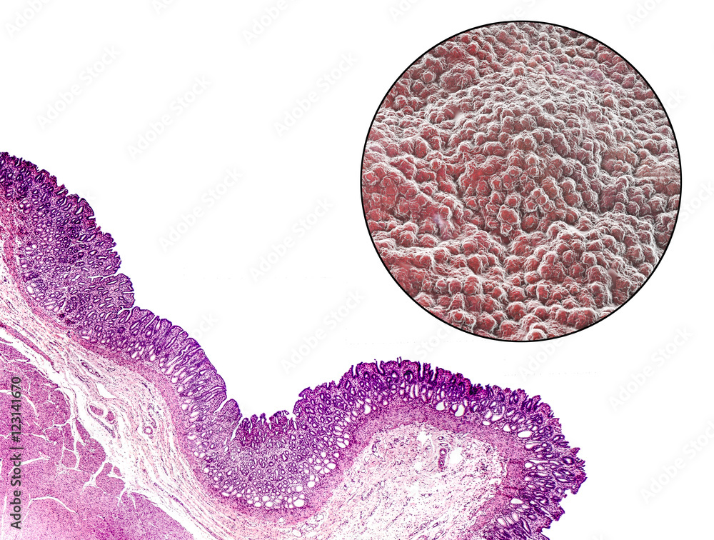 Pyloric mucosa, light micrograph and 3D illustration which show deep ...