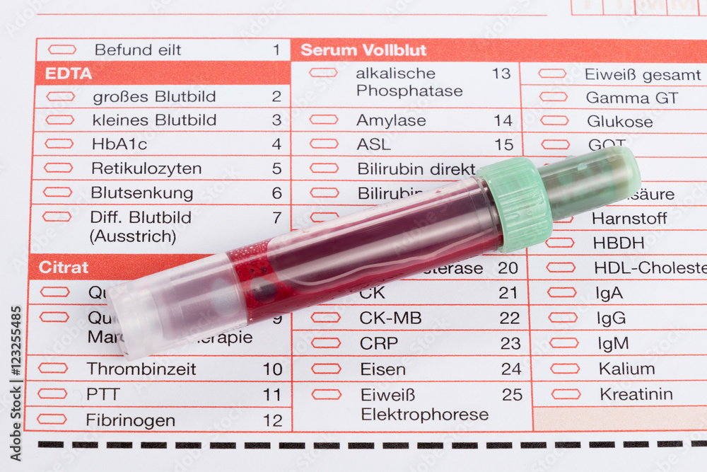Stock-Foto „Blutprobe, Labortest“ | Adobe Stock