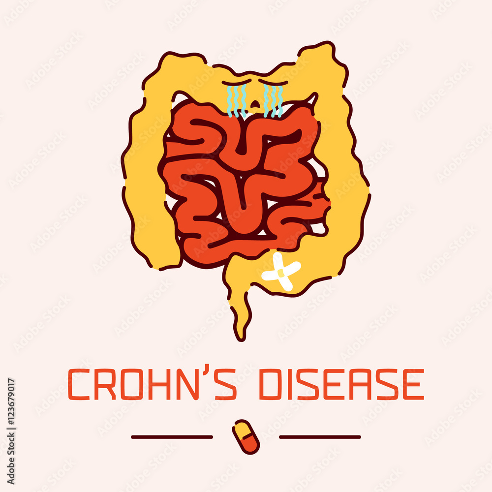 Crohn's disease awareness poster with sad cartoon intestine on white ...
