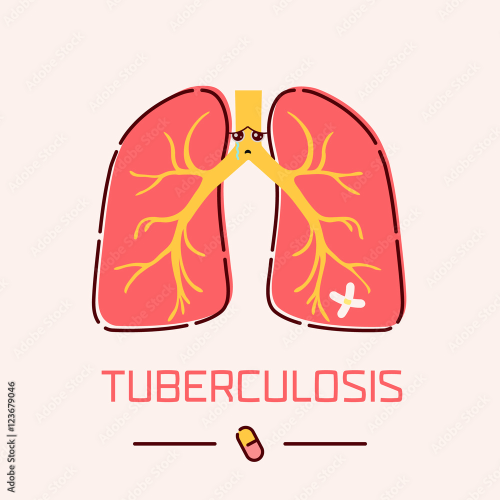 Tuberculosis awareness poster with sad cartoon lungs on light ...