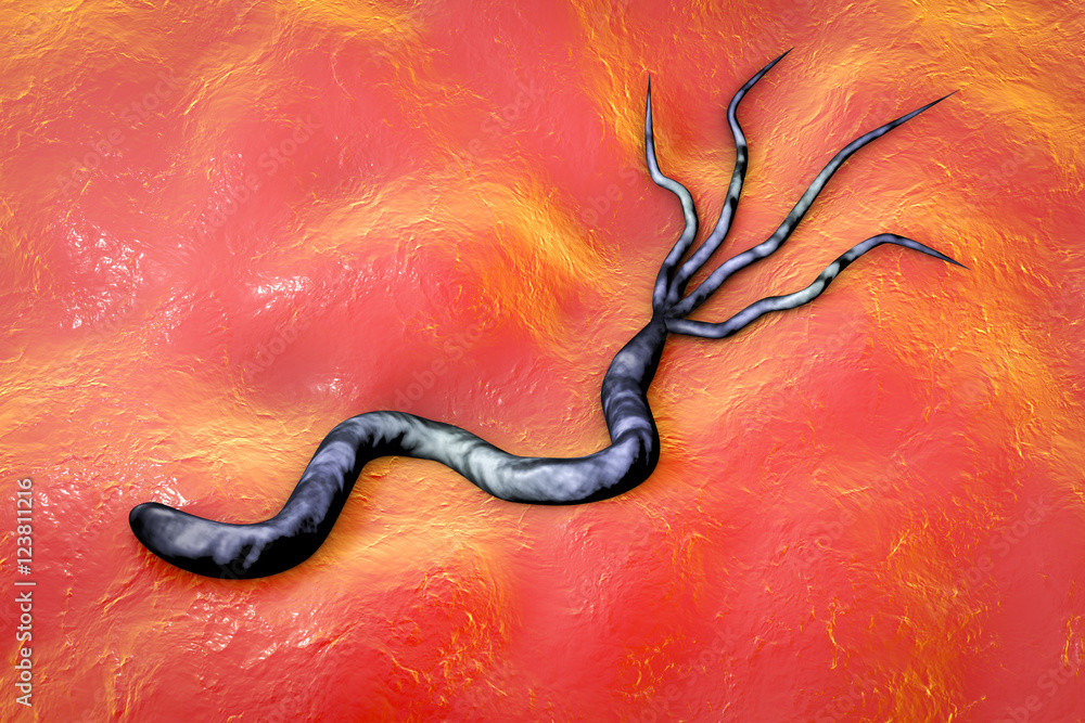 3D illustration of Helicobacter pylori, bacterium which causes gastric ...