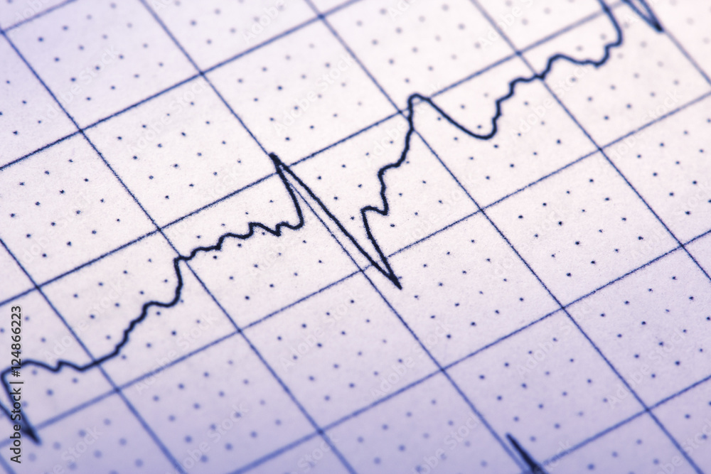 Electrocardiogram, ECG printout, EKG background Stock Photo | Adobe Stock