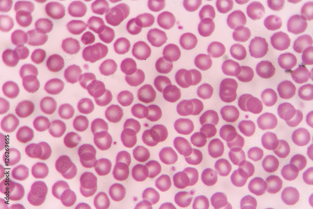 Normal red blood cells Under the microscope Stock Photo | Adobe Stock