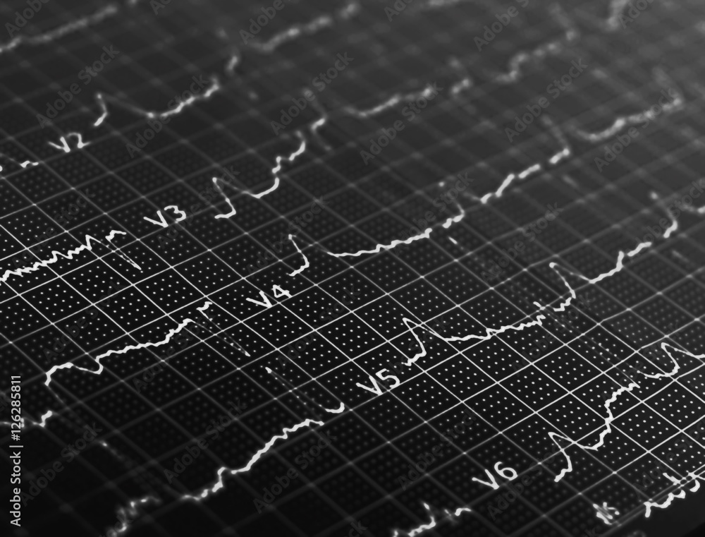 Ecg graph, electrocardiogram background Stock Illustration | Adobe Stock