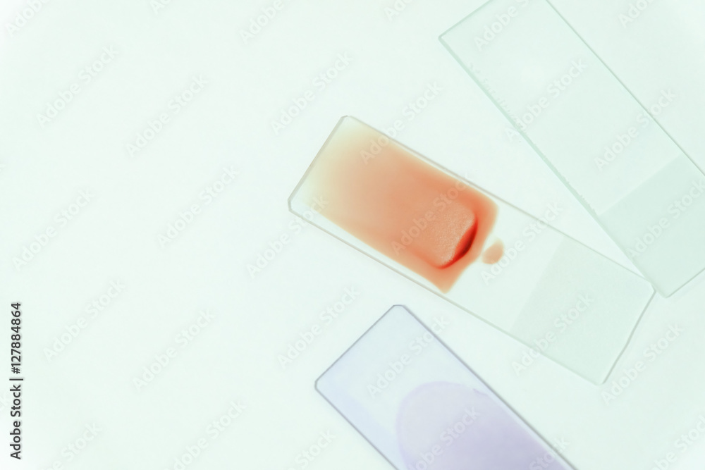 Blood smear for hematology microscopic examination Stock Photo | Adobe ...