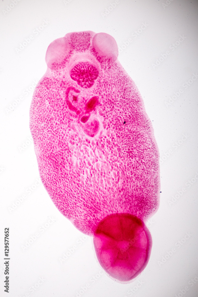 Flukes infestation (parasite) under microscope view. Stock Photo ...