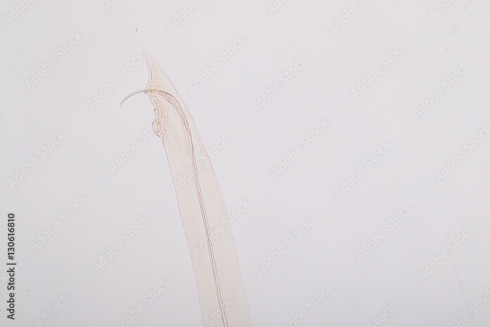 Heterakis gallinarum parasite on slide under microscope view. Stock ...