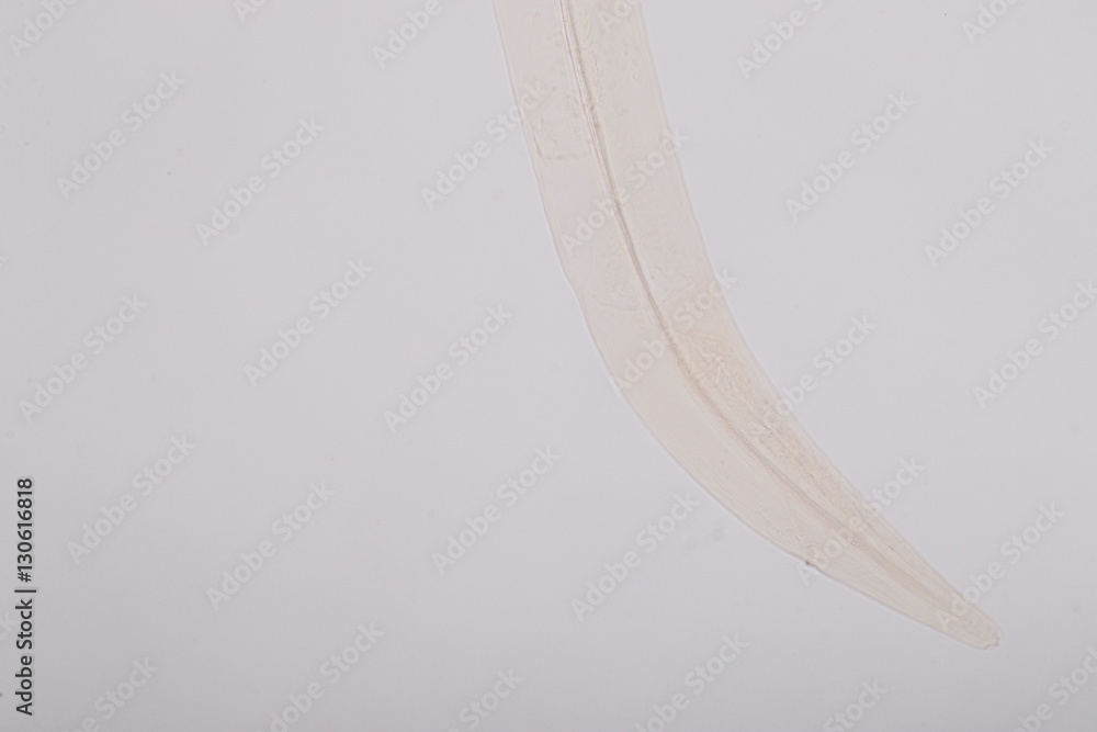 Heterakis gallinarum parasite on slide under microscope view. Stock ...