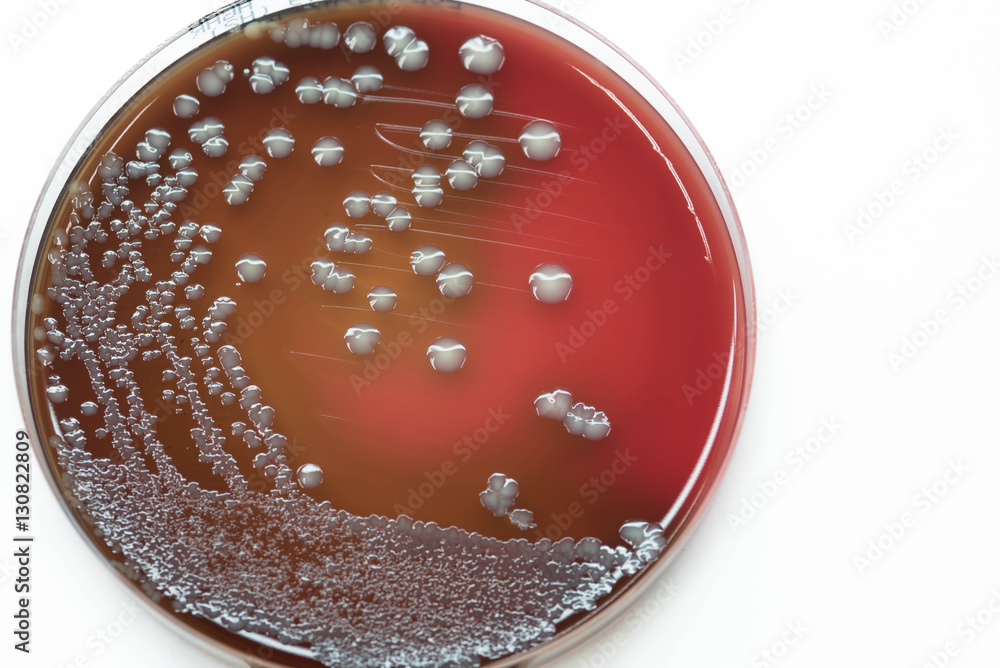 Bacterial culture growth on Blood agar (Gram negative bacilli) Stock ...